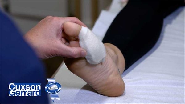 The Hallux Abducto-Valgus Cavity Pad | Hapla Medical Professional Range